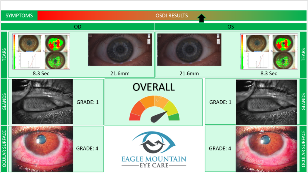 Phoenix Meibography Workstation | Eye-Tech Incorporated