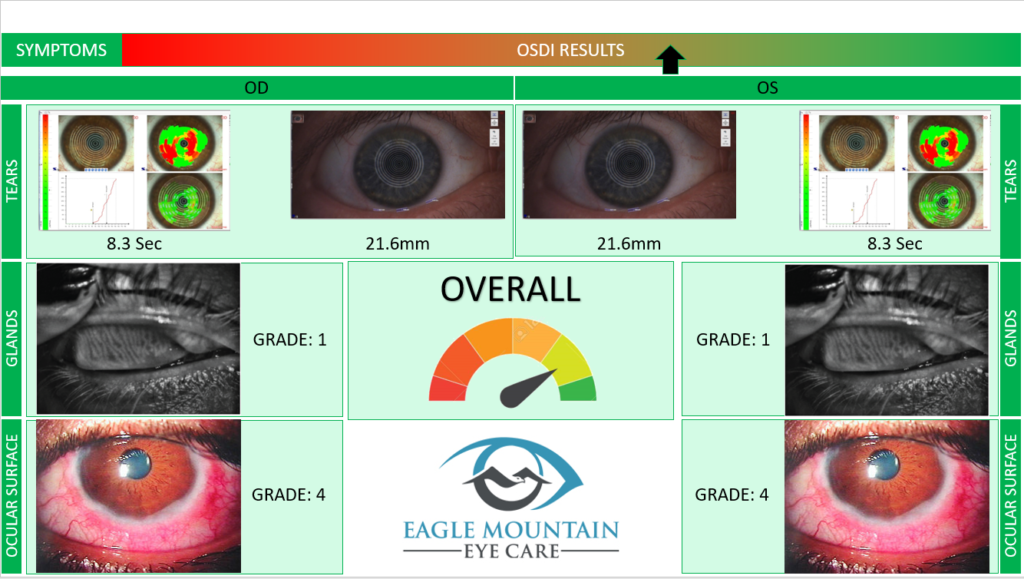 Phoenix Meibography Workstation | Eye-Tech Incorporated