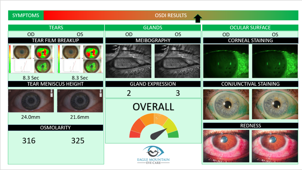 Phoenix Meibography Workstation | Eye-Tech Incorporated