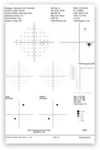 Vf2000 Visual Field Headset | Eye-Tech Incorporated